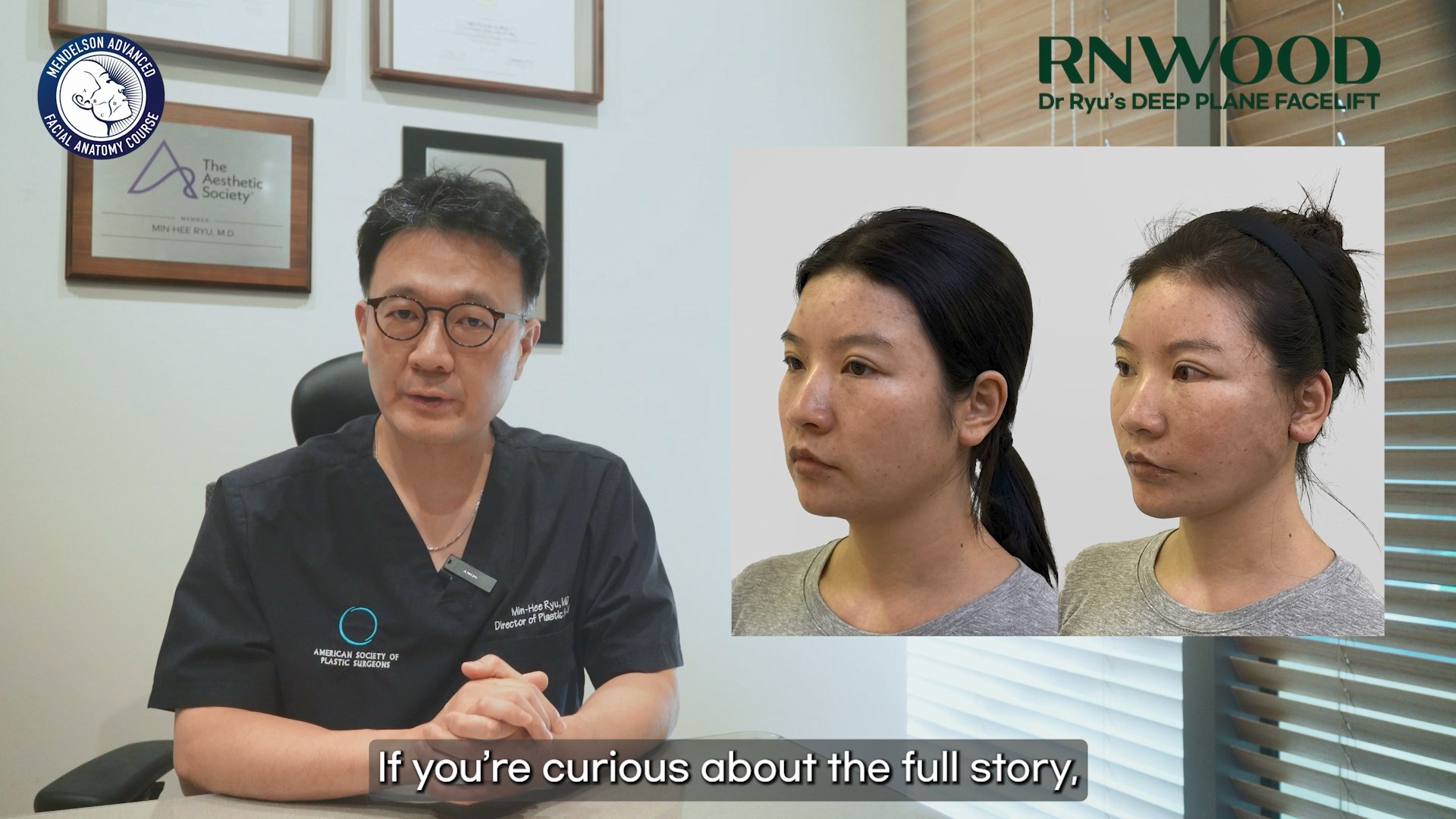 Dr Ryu’s Deep Plane Facelift CASE - Deep Plane Facelift Dr. Min-Hee Ryu