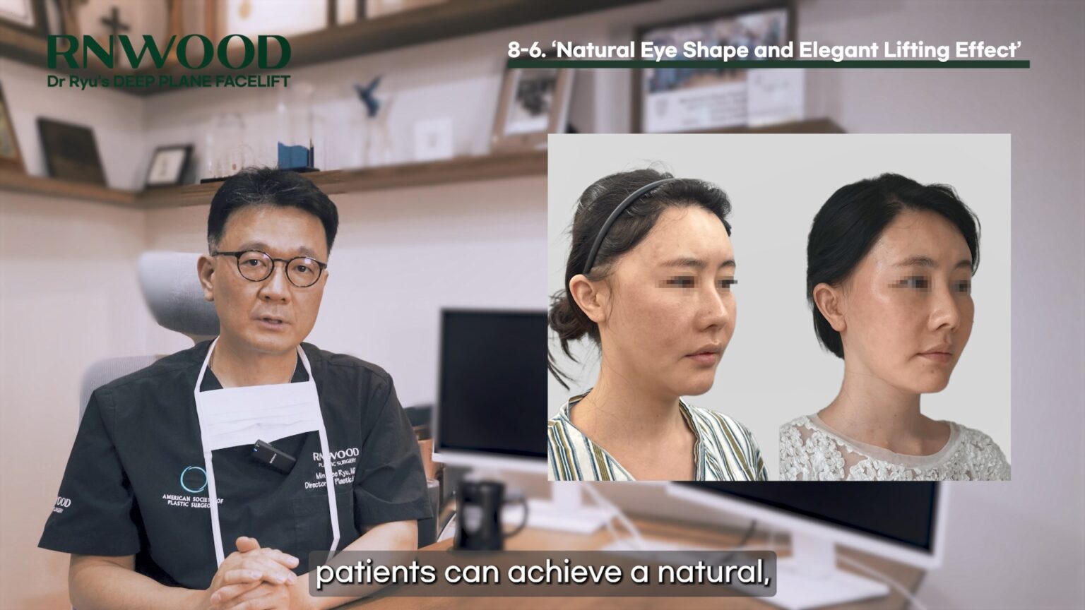 [8 Key Features of ‘Dr. Ryu's DEEP PLANE FACELIFT’] 8-6. ‘Natural Eye ...