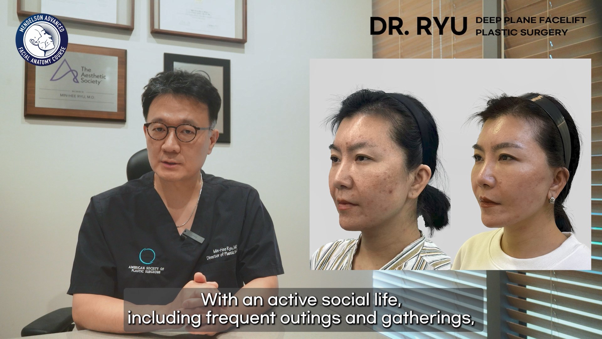 Review Case 1: Dr Ryu’s Deep Plane Facelift - Deep Plane Facelift Dr ...