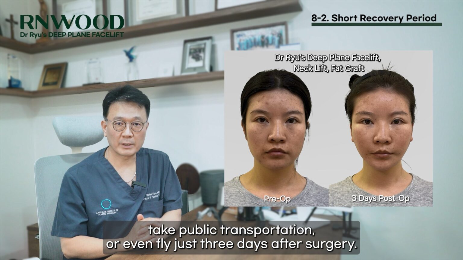 [8 Key Features of ‘Dr. Ryu's DEEP PLANE FACELIFT’] 8-2. Short Recovery ...