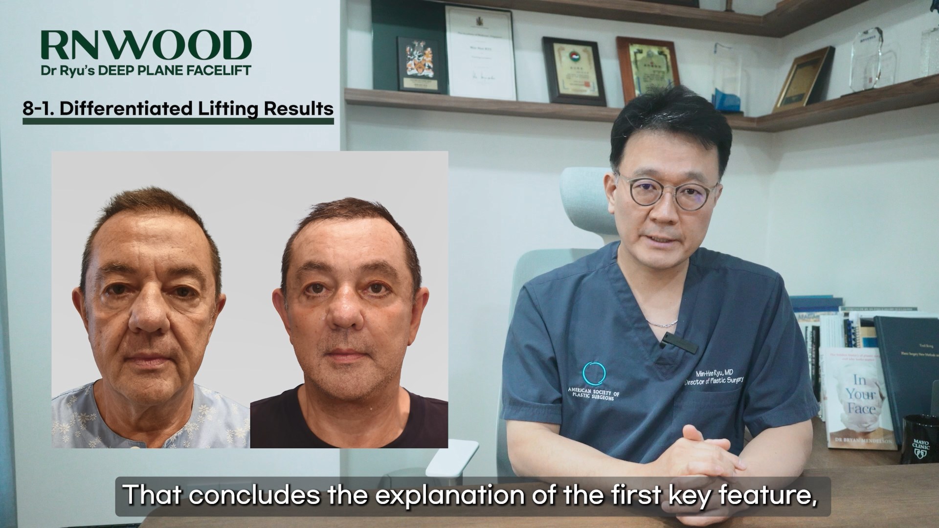 [8 Key Features of ‘Dr. Ryu's DEEP PLANE FACELIFT’] 8-1. Differentiated ...